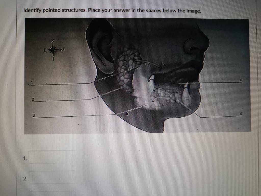 Solved Identify pointed structures. Place your answer in the | Chegg.com