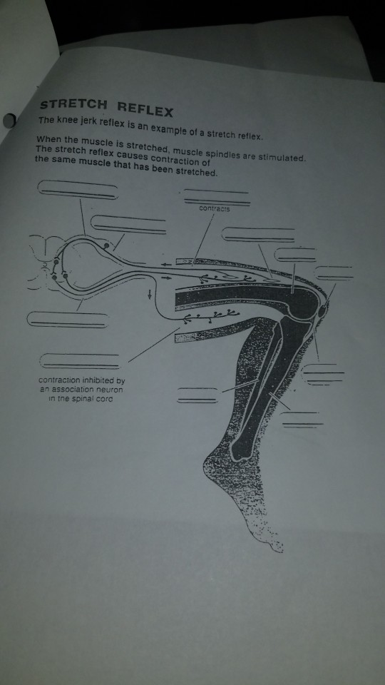Solved STRETCH REFLEX The knee jerk reflex is an example of | Chegg.com