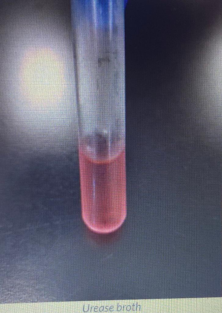 The pink/fuschia color in the medium above indicates | Chegg.com