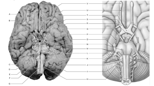 Solved please label | Chegg.com