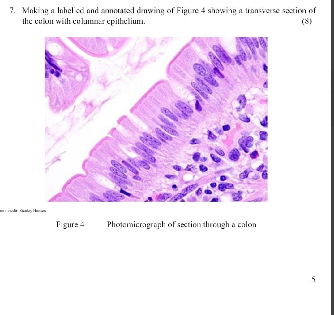 Solved 7. Making a labelled and annotated drawing of Figure | Chegg.com