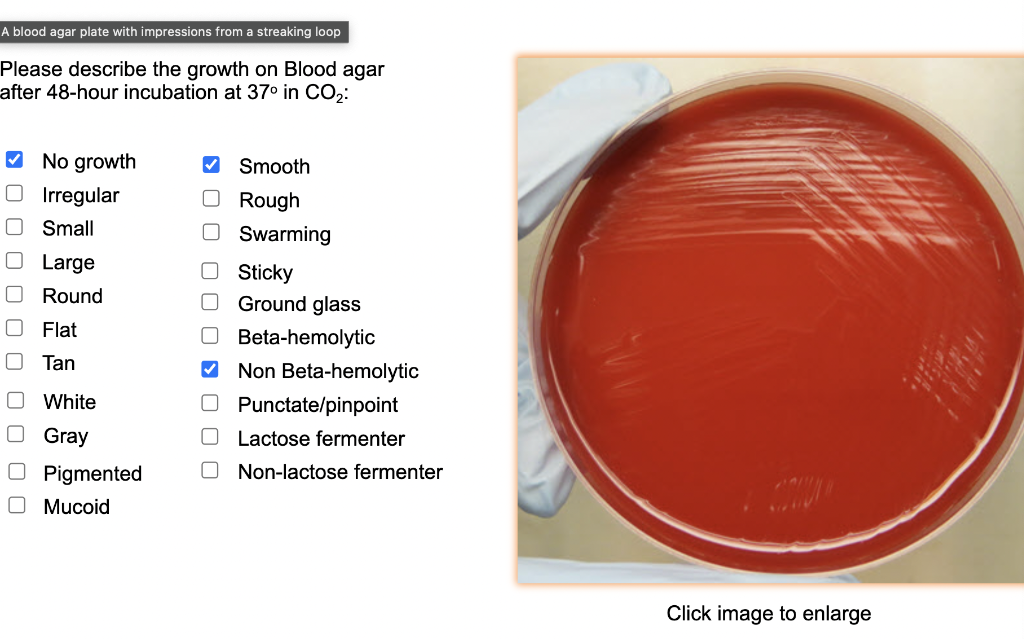 Solved Please describe the growth on Blood agar after | Chegg.com