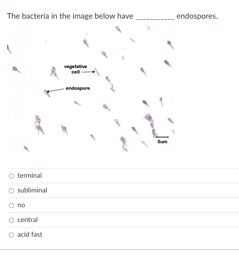 Solved The bacteria in the image below have endospores. | Chegg.com