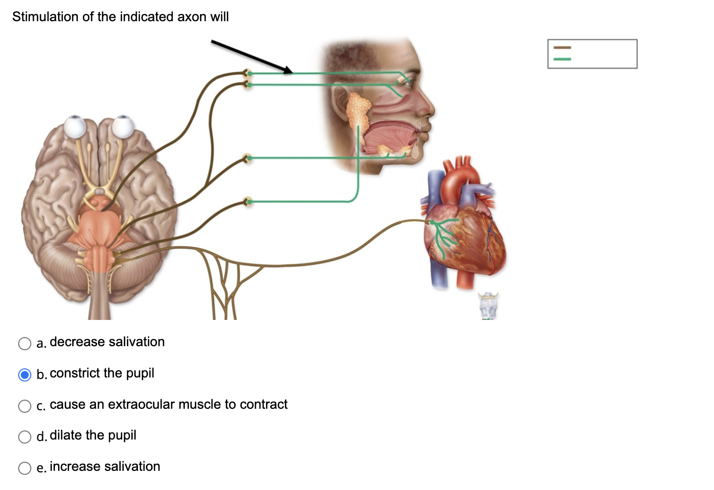 Solved Stimulation of the indicated axon willa. ﻿decrease | Chegg.com