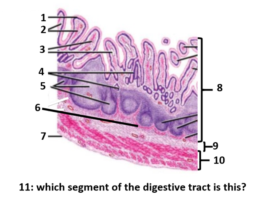 Solved Digestive System:- Identify the organ/tissue and | Chegg.com