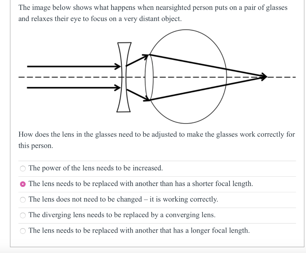 Solved The image below shows what happens when nearsighted | Chegg.com