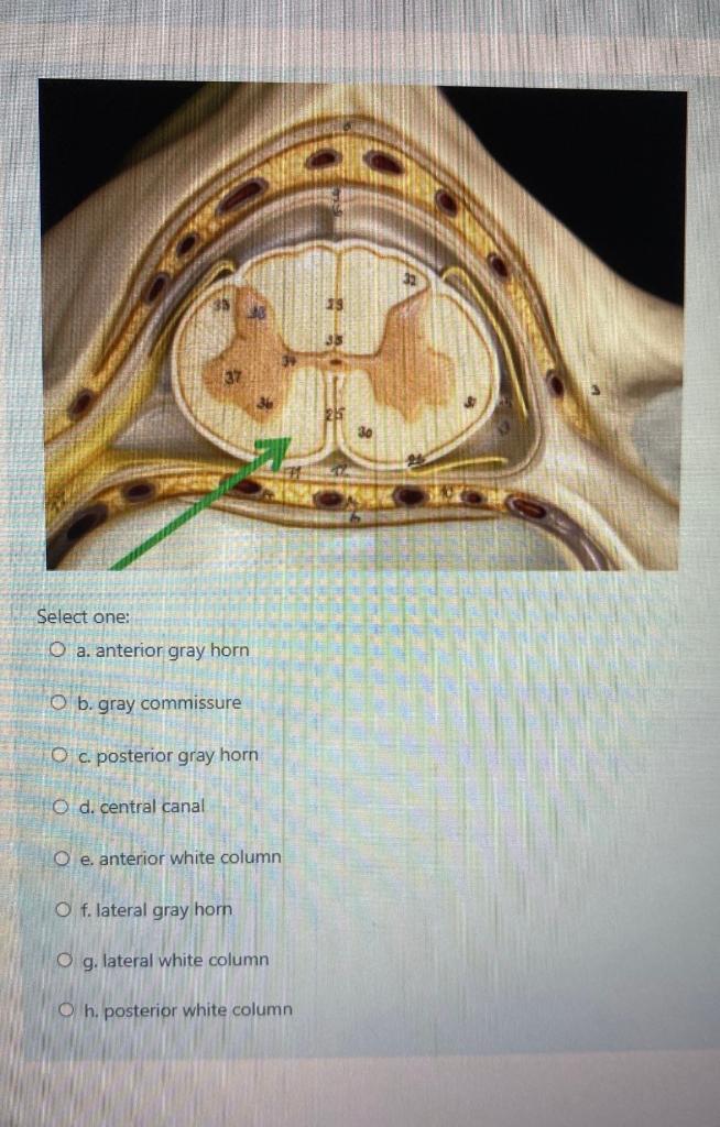 Solved Select one: O a. anterior gray horn O b. gray | Chegg.com