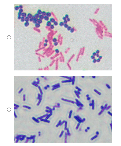 Solved Microbiology - Clinical Microbiology and Rapid | Chegg.com