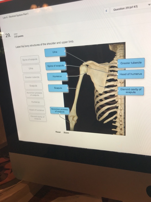 Question 29 (of 47) Lab 6-Skeletal System Part 212 | Chegg.com