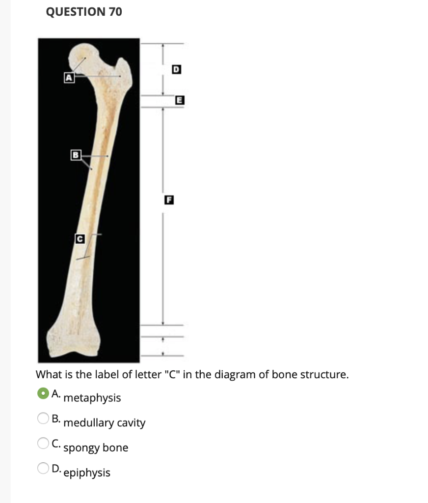 Medullary Cavity Diagram