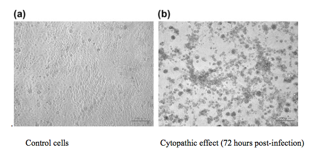 Solved Describe the type of Cytopathic effect observed | Chegg.com