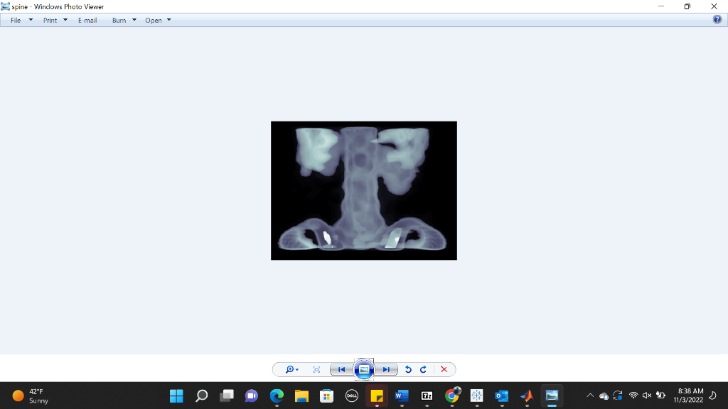 Question 4. Load the image spine.tif from MATLAB. And | Chegg.com