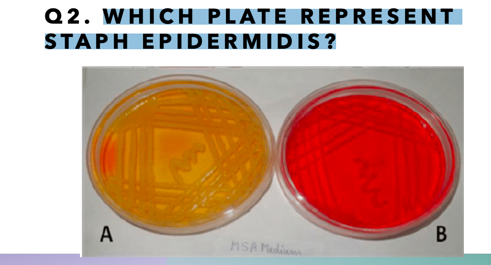Solved Q3. WHICH REACTION ON CATALASE TEST REPRESENT | Chegg.com