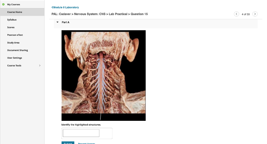 Solved Pal Cadaver Nervous System Cns Lab Practical