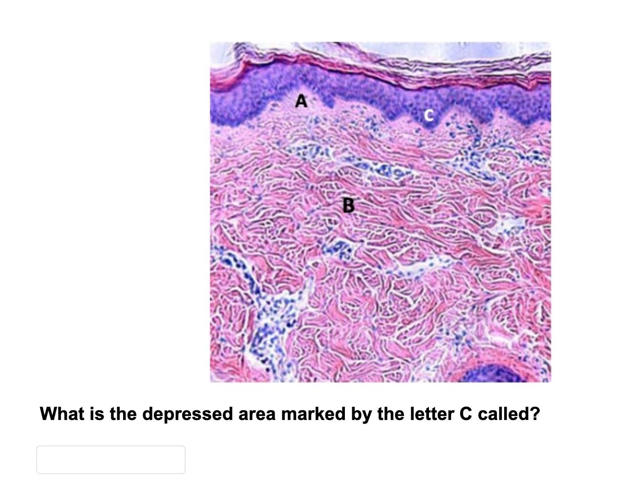 Solved What is the depressed area marked by the letter C | Chegg.com