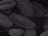 Solved Implement histogram equalization on those three | Chegg.com