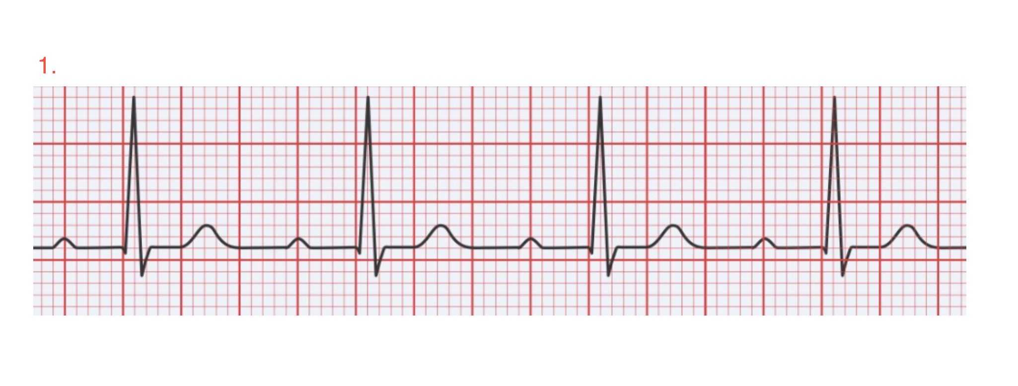 Solved Please find Heart Rate and Rhythm (regular/irregular) | Chegg.com