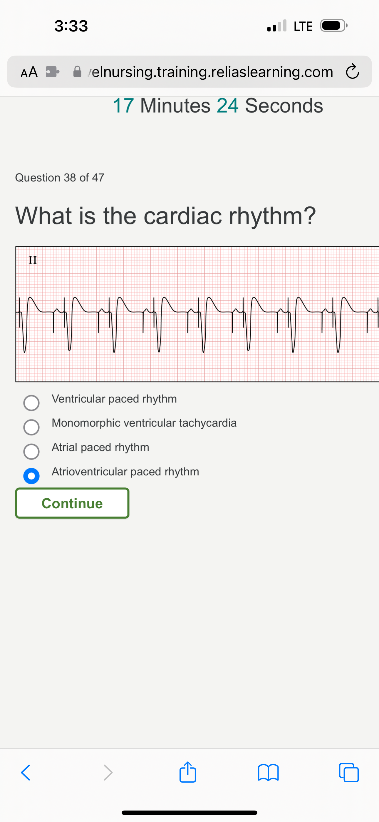 Solved What is the cardiac rhythm?Ventricular paced | Chegg.com