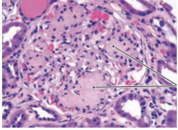 Solved The patient is a 66-year-old female with a PMHx of | Chegg.com