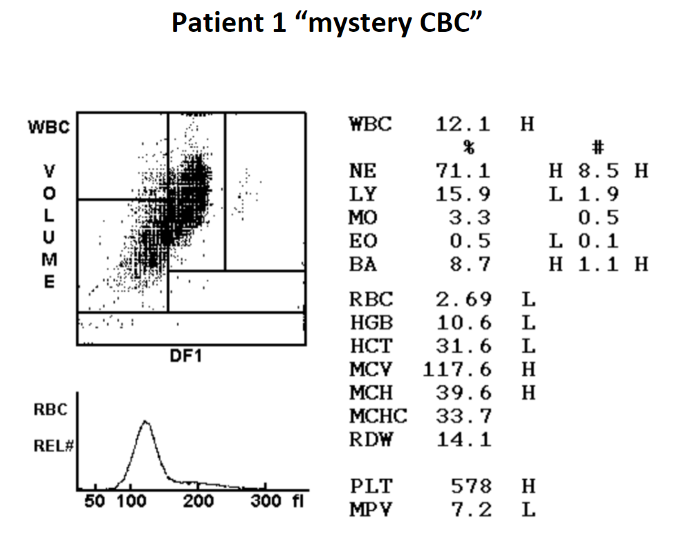 Solved CBC from a normal patient scan and readout: WBC MO | Chegg.com