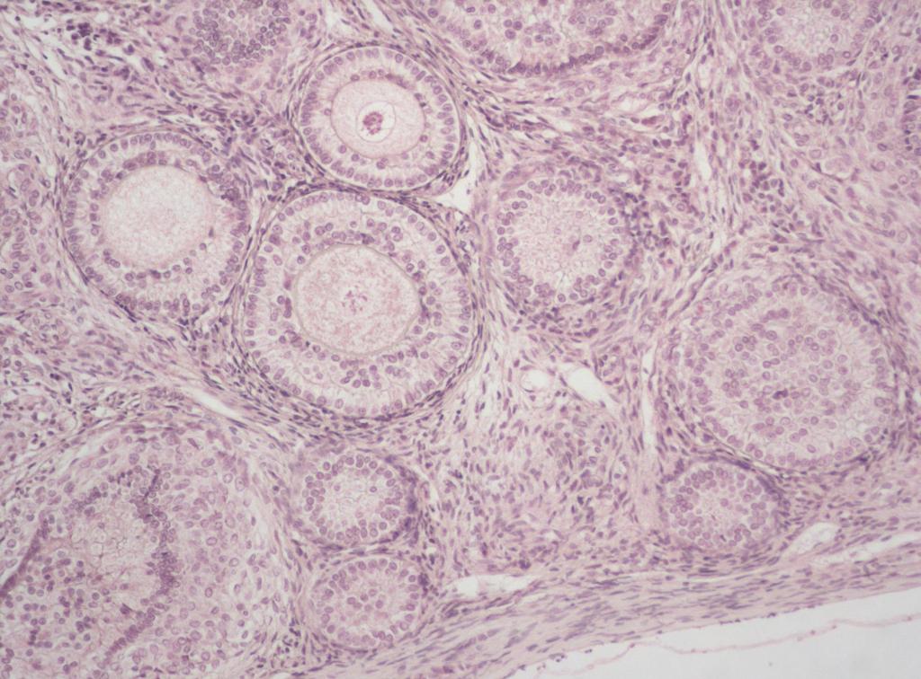 Solved Where is the primordial follicle and the primary | Chegg.com
