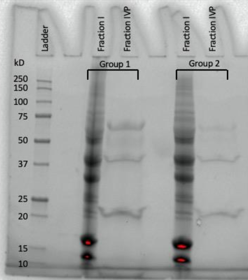 Looking at the ladder, why are the 75-kD and 50-kDa | Chegg.com