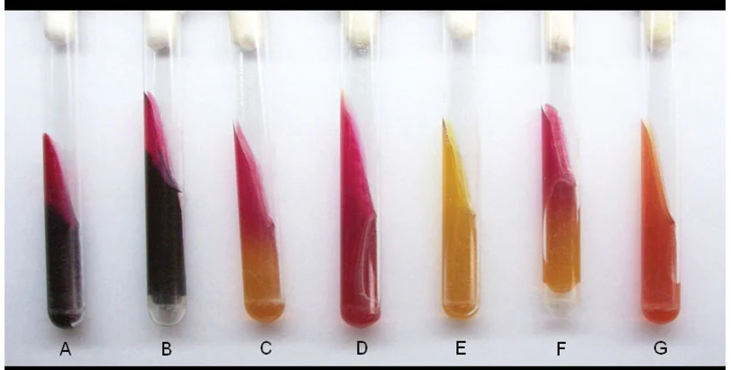 Solved What is the tsi result and what is the possible | Chegg.com