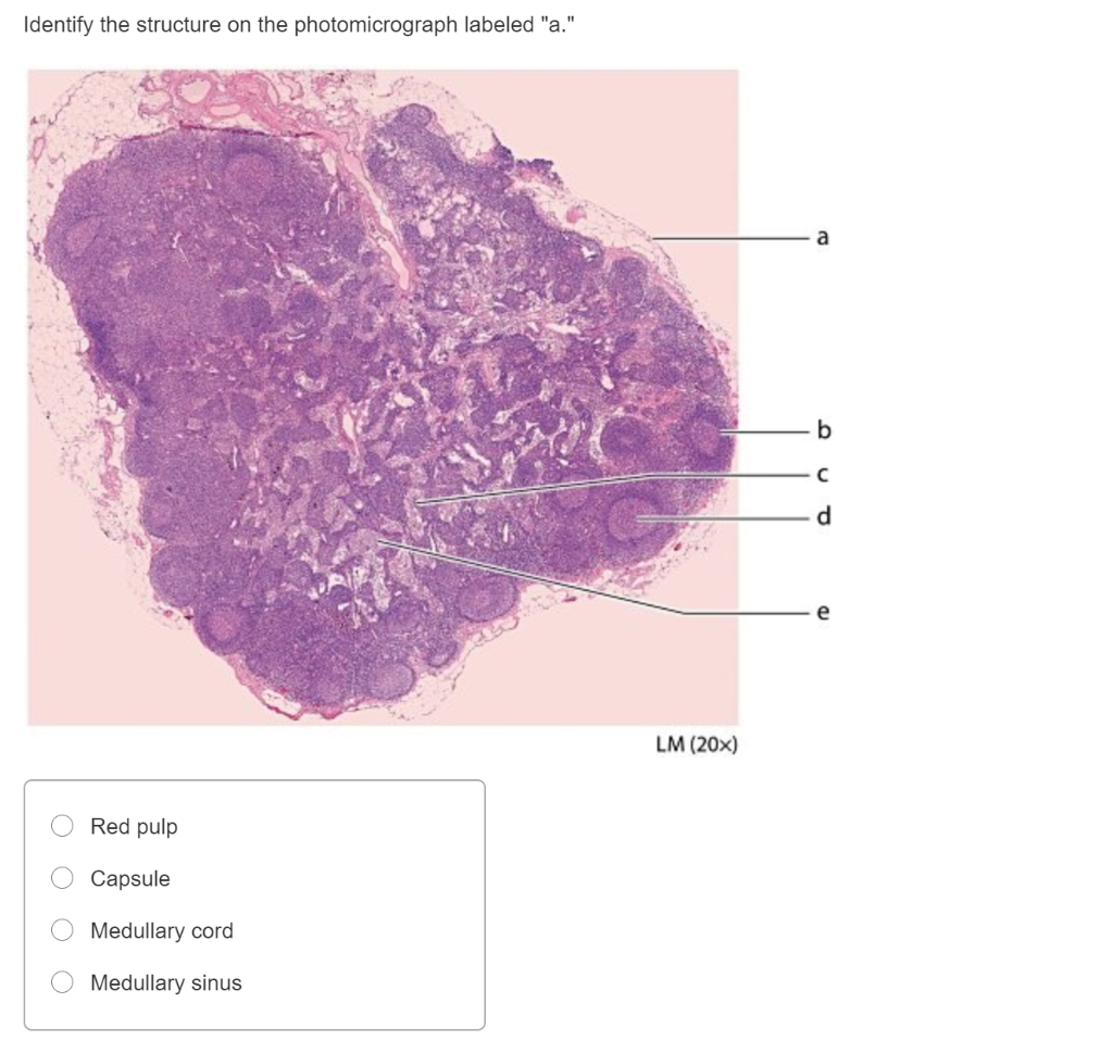Solved Identify the structure on the photomicrograph labeled | Chegg.com