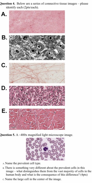 Solved Question 4. Below are a series of connective tissue | Chegg.com