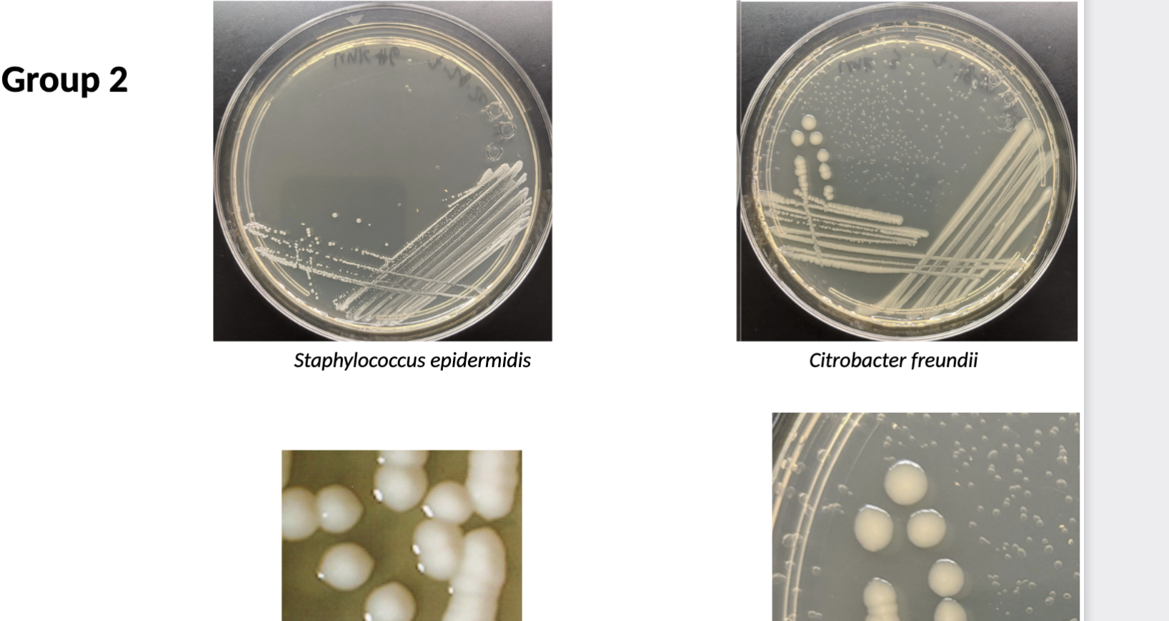 Solved Lab 2 - Aseptic Technique and Streak Isolation | Chegg.com