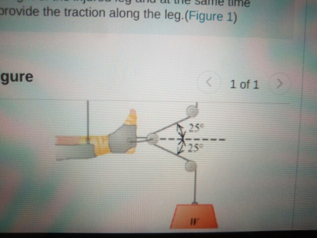 Solved Chapter 5 Problem 5.08: Traction apparatus. In order | Chegg.com