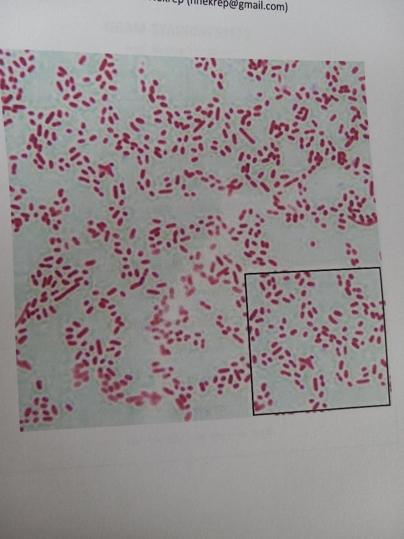 Solved Nekrep innekrep@gmail.com) GRAM STAINING WORKSHEET 1. | Chegg.com