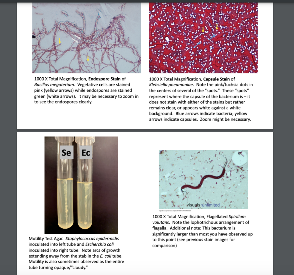 Staphylococcus Epidermidis Capsule Stain