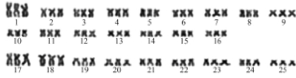 Solved The following figure shows the karyotype of an | Chegg.com