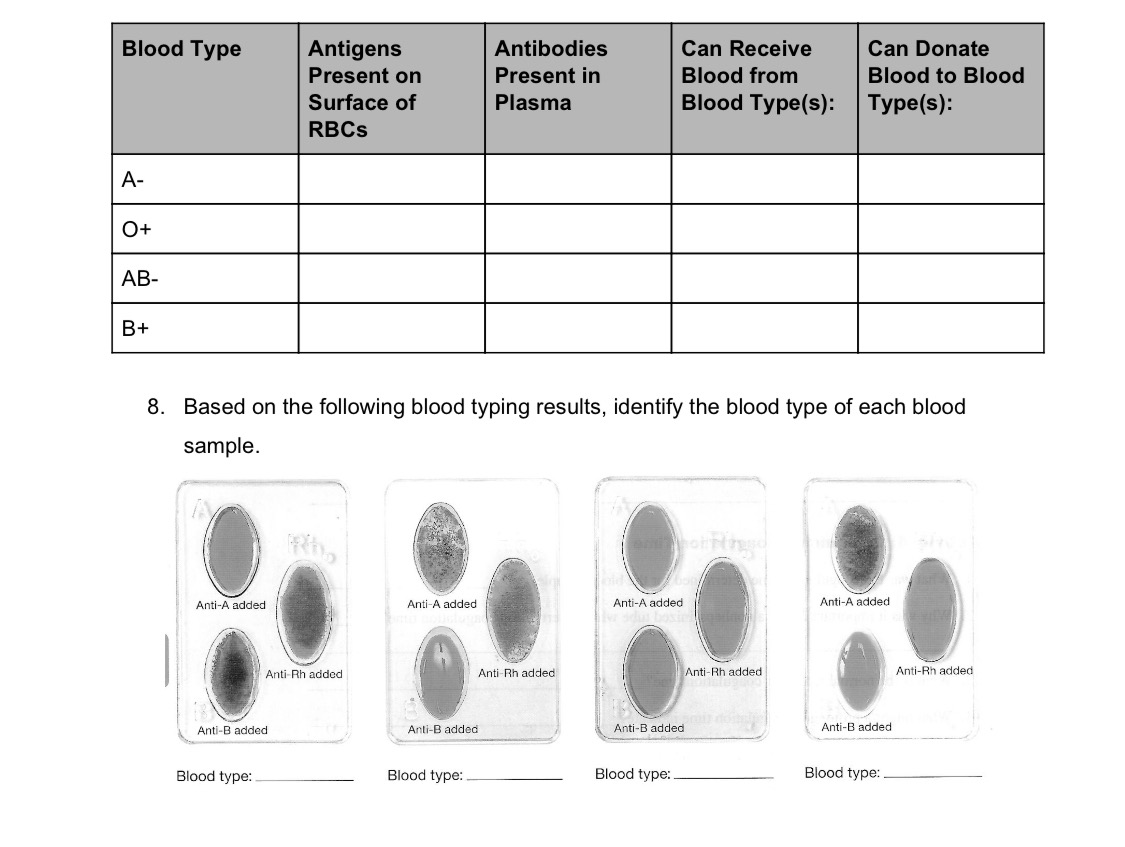 Blood Type O Rbc Antigens Quizlet at Larry Childs blog