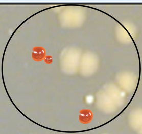 Solved 9.Define: 8pts Aerotolerance – Anaerobic – Aerobic | Chegg.com