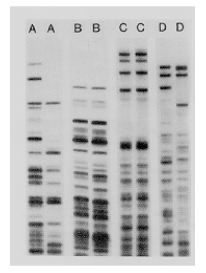 Solved Shown below is DNA banding patterns (restriction | Chegg.com