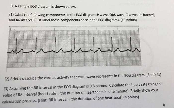 Solved .A sample ECG diagram is shown below. Label the | Chegg.com