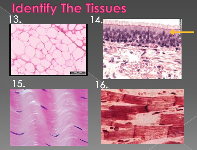 Solved Identify The Tissues Tissue indicated by the pointer | Chegg.com