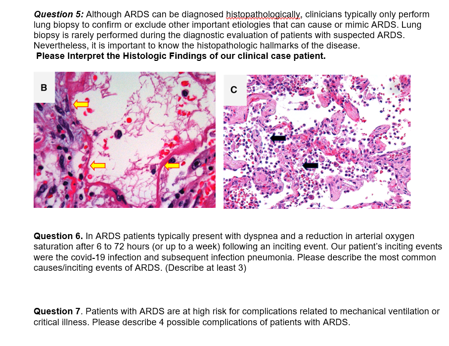 Solved Question 5: Although ARDS can be diagnosed | Chegg.com