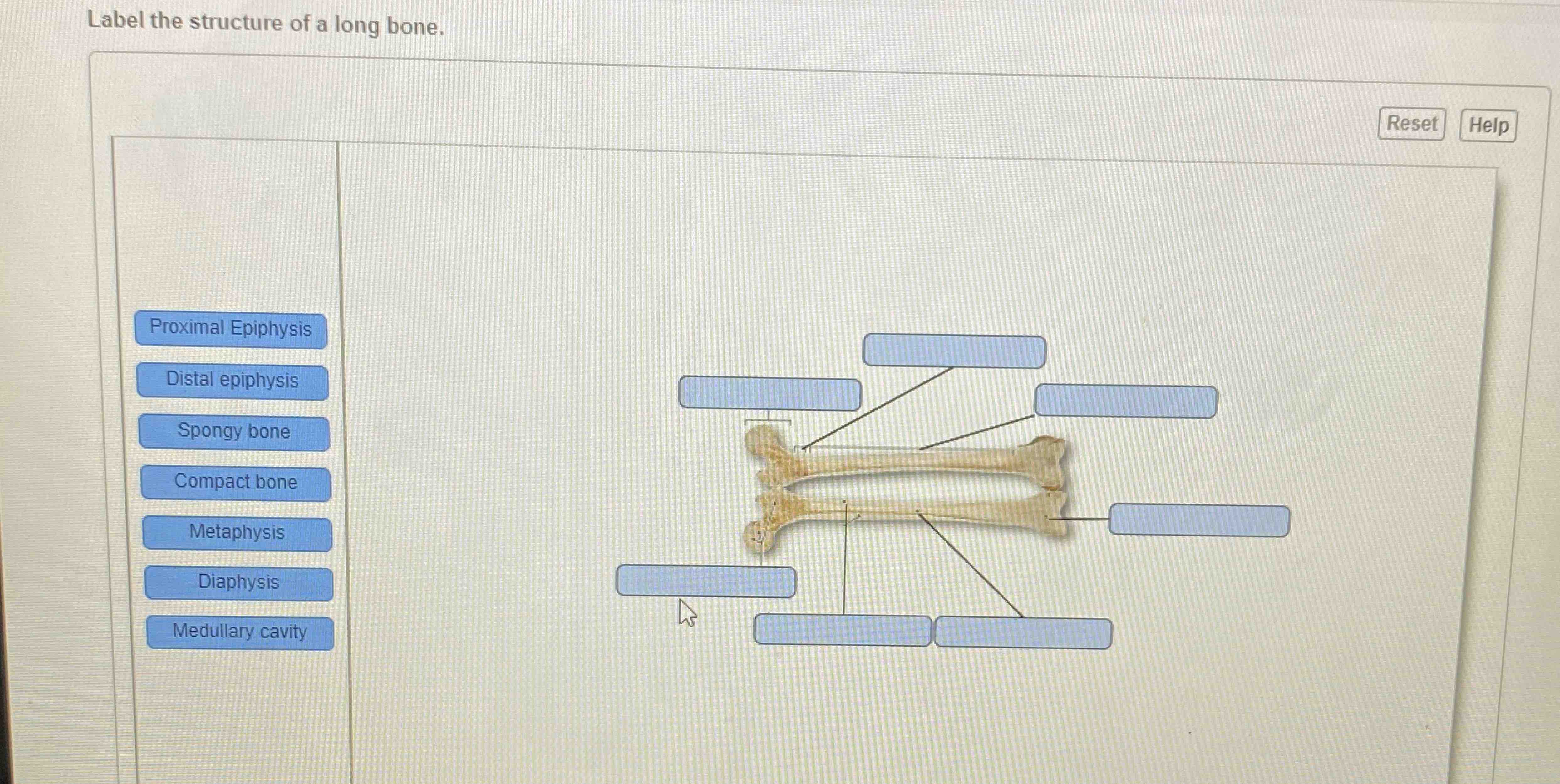 Solved Label the structure of a long bone.Proximal | Chegg.com
