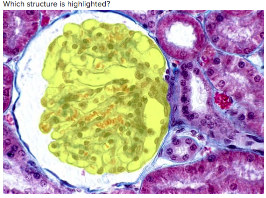 Solved Which structure is highlighted? Which structure is | Chegg.com