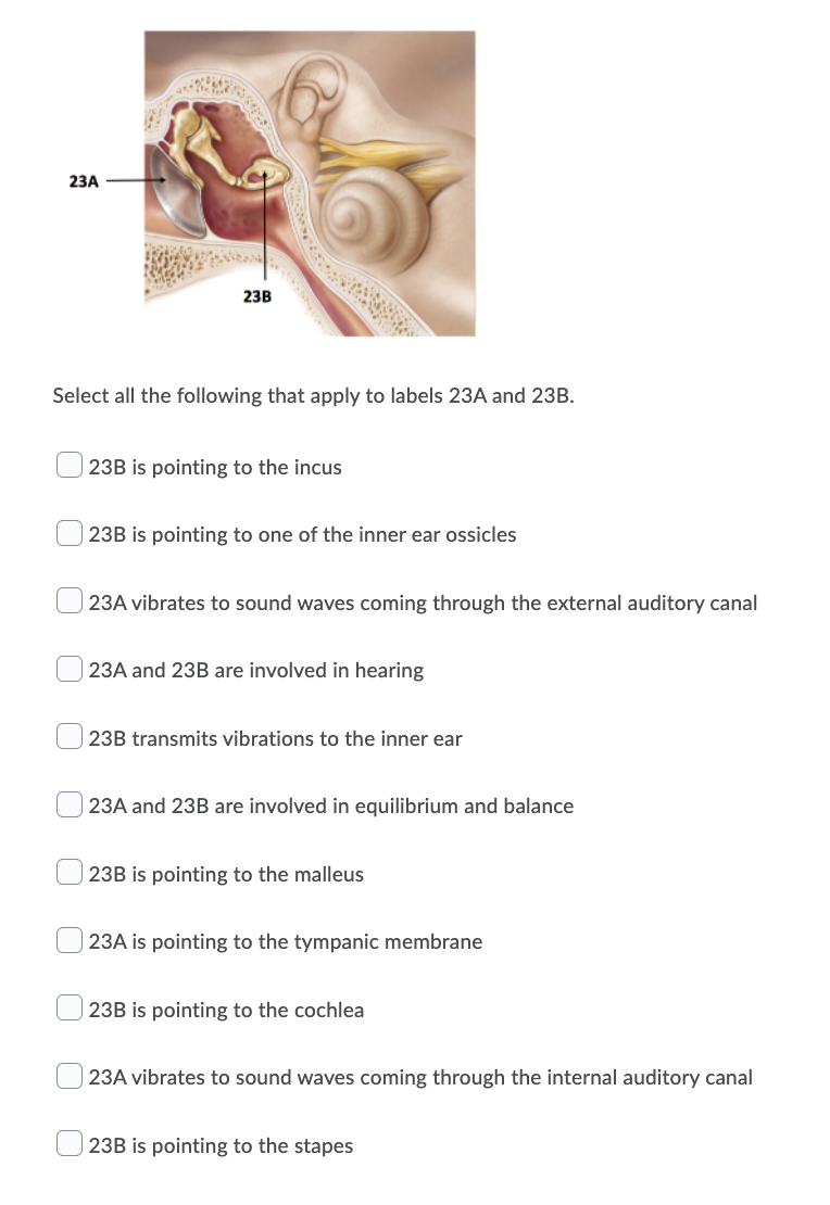 Solved 23A 23B Select all the following that apply to labels | Chegg.com