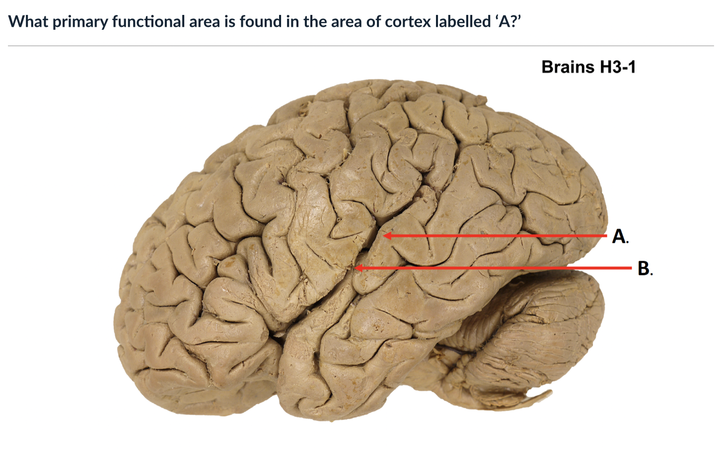 Solved What primary functional area is found in the area of | Chegg.com