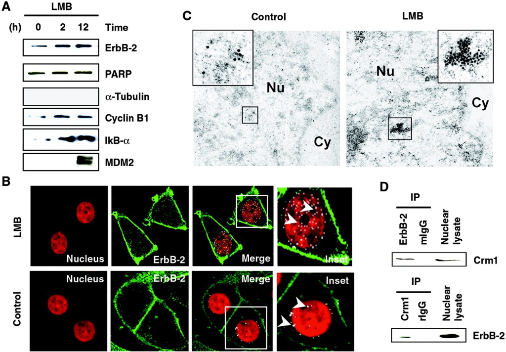 Solved Cells are treated with the drug leptomycin B (LMB) | Chegg.com