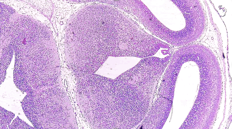 Solved I need help labelling these 2 images, they are | Chegg.com