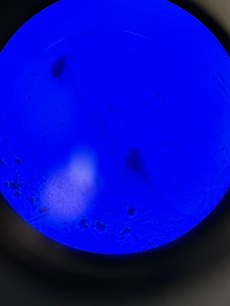 Solved 1. What is the procedure of methyl blue staining? 2. | Chegg.com