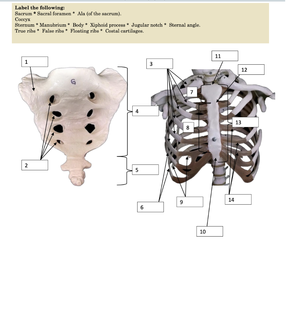Solved Label the following: Sacrum * Sacral foramen * Ala | Chegg.com