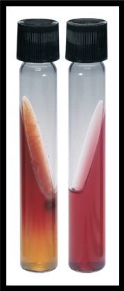 Solved In this photo, a known organism, Proteus mirabilis, | Chegg.com