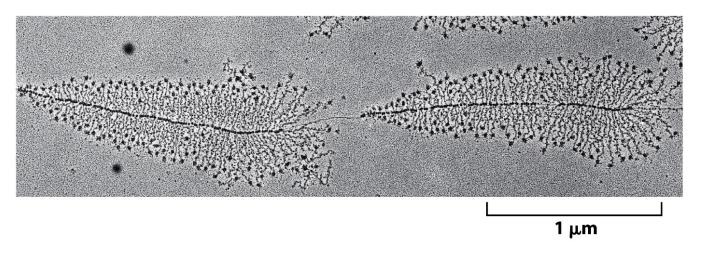 Solved Question D2 A Figure below is an electron micrograph | Chegg.com